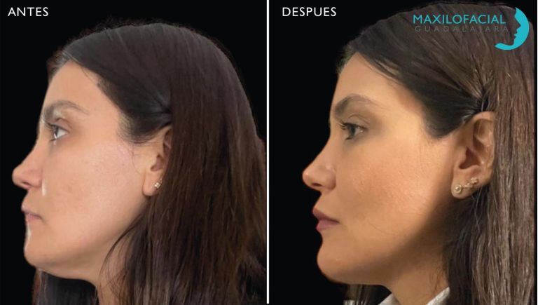 Maxilofacial Guadalajara